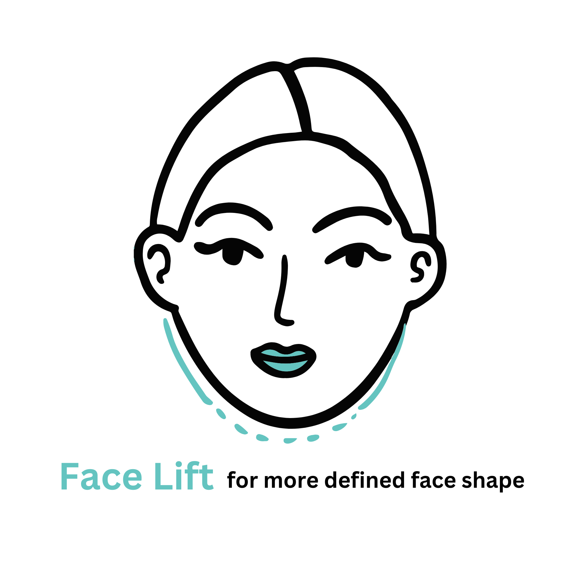 Thread Lift - A Non-Surgical Solution for a Youthful Appearance